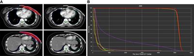 Frontiers | 3D-printed bolus ensures the precise postmastectomy chest ...