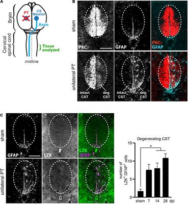 Frontiers | LZK-dependent stimulation of astrocyte reactivity promotes ...