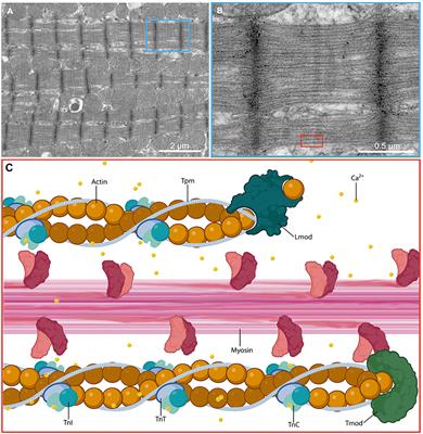 Frontiers | Thin filament cardiomyopathies: A review of genetics ...