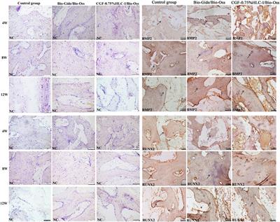 Frontiers | CGF-HLC-I repaired the bone defect repair of the rabbits ...