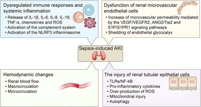 Sepsis Pathophysiology Made Easy