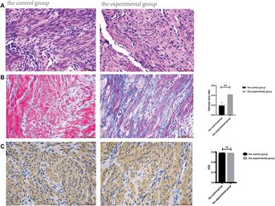 Frontiers | Characteristics and transcriptomic analysis of scar tissues ...