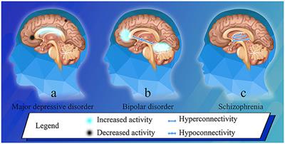 Frontiers | Commentary: Targeting the MRI-mapped psychopathology of ...
