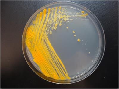 Frontiers | Characterization of Mycobacterium salfingeri sp. nov.: A ...