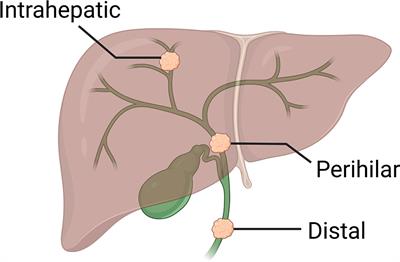 Frontiers | Intrahepatic cholangiocarcinoma: The role of liver ...