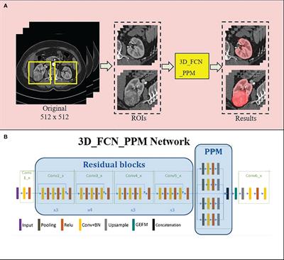 Frontiers | A novel 3D deep learning model to automatically demonstrate ...