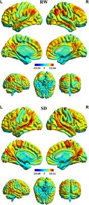Frontiers | Altered stability of brain functional architecture after ...