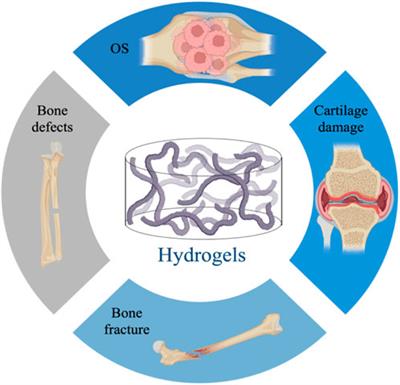 Frontiers | Therapeutic application of hydrogels for bone-related diseases