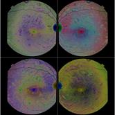 Models to study malaria parasite-host cell interactions and ...