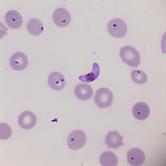 Advanced Genetic and Genomic Methods and Applications for Malaria ...