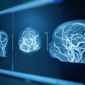 Neuroanatomical Considerations and Advances in Approaches for Cerebral ...