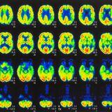 Rapid Image Reconstruction | Frontiers Research Topic