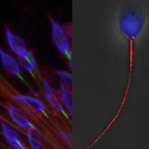 Sperm Differentiation and Spermatozoa Function: Mechanisms, Diagnostics ...