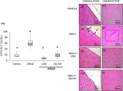 Frontiers | Hepatoprotective effect of hydroalcoholic extract from root ...