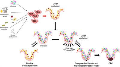 Frontiers | Colorectal cancer and therapy response: a focus on the main ...