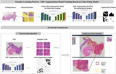 Frontiers | Development and external validation of a transfer learning ...