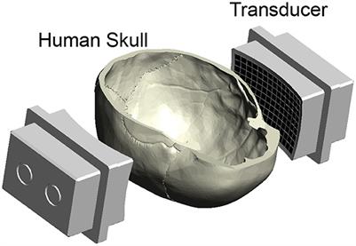 Frontiers | Controlled ultrasonic interventions through the human skull