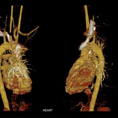 Frontiers in Radiology | Cardiothoracic Imaging