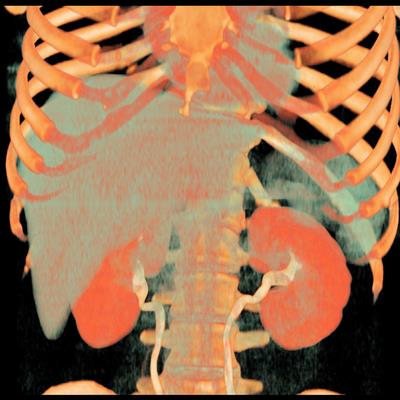 Frontiers in Nephrology